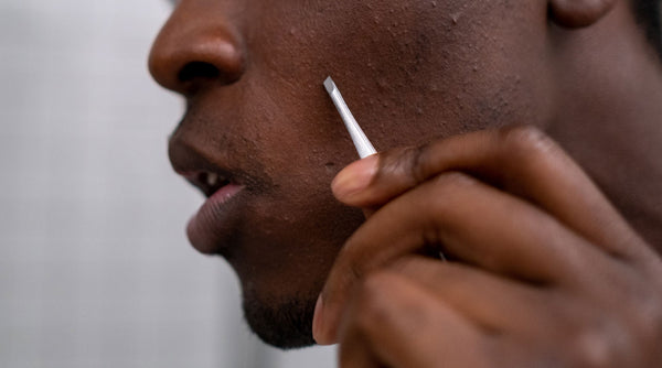 Summer Waxing Woes: Here’s Why Your Clients Keep Getting Ingrown Hairs ...